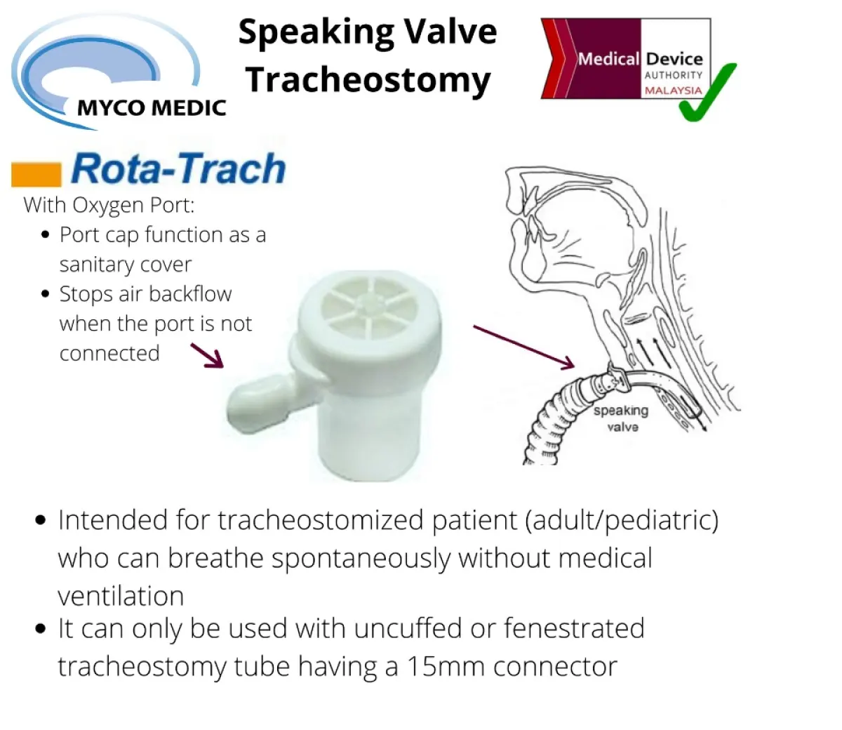 Tracheostomy speaking device